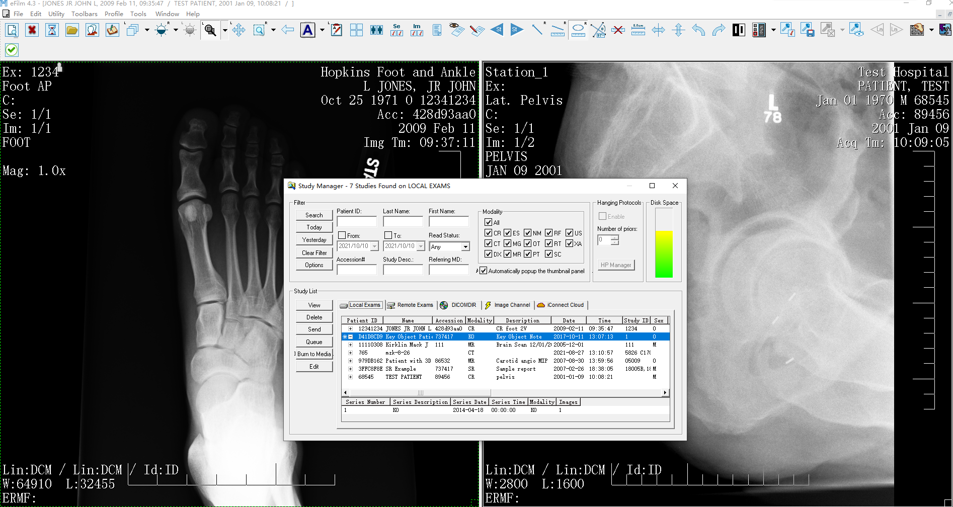 eFilm Workstation dicom 4.3 vs radiant dicom-CSDN博客