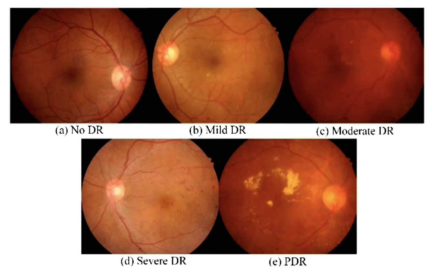 coarse-to-fine(1) CF-DRNet_coarse to fine-CSDN博客