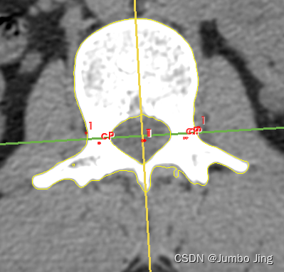 vtk的截面多边形裁切和质心的探索实验之二：连通过滤器vtk.vtkConnectivityFilter()_vtkconnectivityfilter类获取单个连通区域的点-CSDN博客