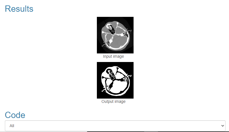 训练过程出现trian_dice一直大于1（mask范围0-255转为0-1）_dice系数大于1_吨吨不打野的博客-CSDN博客