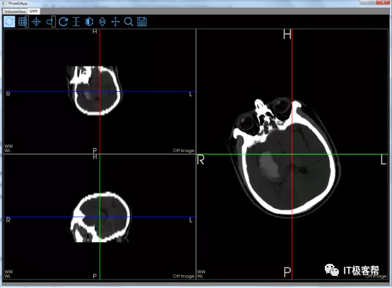 VTK系列教程三：项目实战介绍_vtk在wpf中使用-CSDN博客