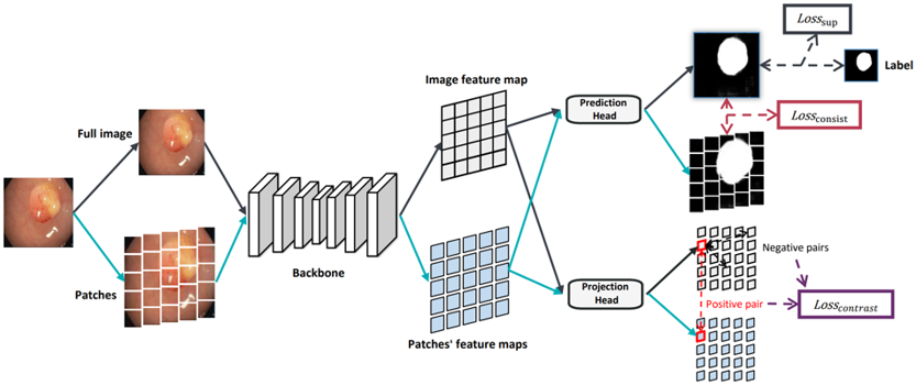 [论文阅读] Cross-level Contrastive Learning and Consistency Constraint for Medical Image ...