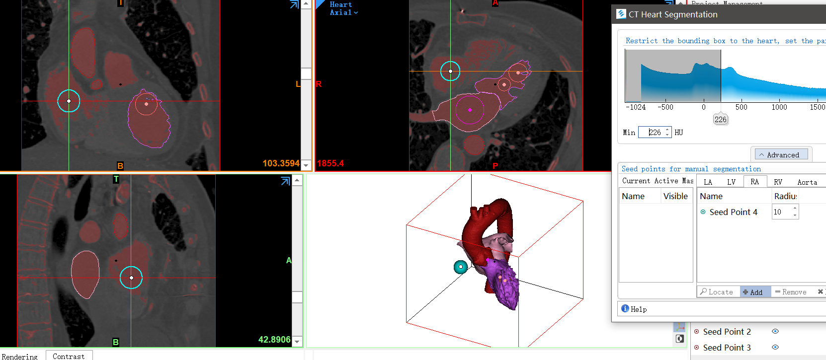 【Mimics】基于心脏ct影像重建3d模型 孔洞修复平滑处理 及 合并导出_ct数据 3d建模-CSDN博客