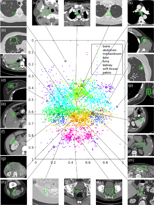 PyTorch实现联邦学习目标检测 单阶段retinanet-csv自定义数据集 DeepLesion_deeplesion数据集-CSDN博客