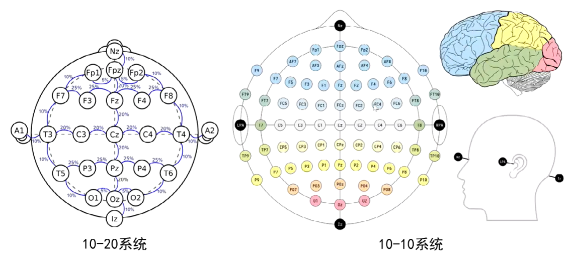 EEG脑电数据预处理_eeg预处理-CSDN博客