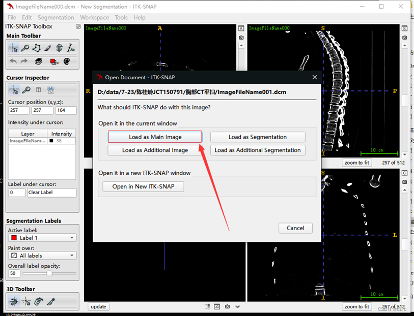 ITK-snap医学图像标注方法（超级详细）——保姆级_itk snap-CSDN博客