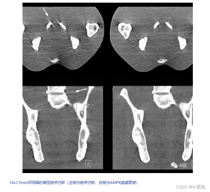 CT伪影：根本原因与规避方法_小鼠ct运动伪影-CSDN博客