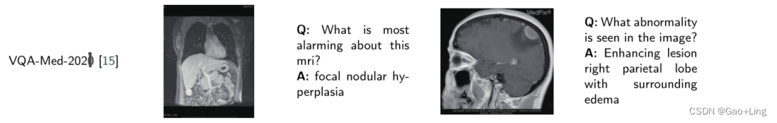 医学视VQA——综述_vqa-rad-CSDN博客