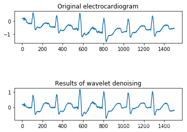 【C4】基于深度学习的心电信号分析_数据分析心电信号预测-CSDN博客