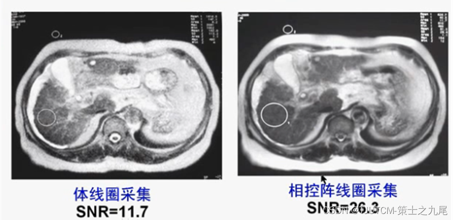 MRI原理与CEST相关简介_cest mri-CSDN博客