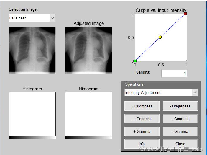 医学图像增强系统的设计_kaic-CSDN博客
