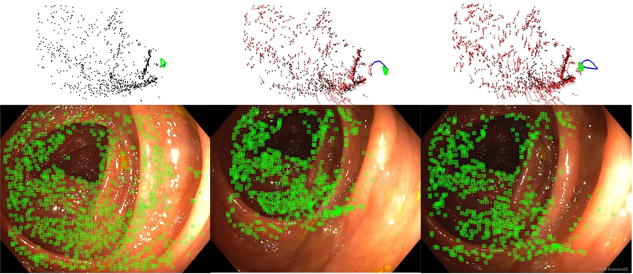 【论文翻译】Tracking monocular camera pose and deformation for SLAM inside the human body_endomapper ...