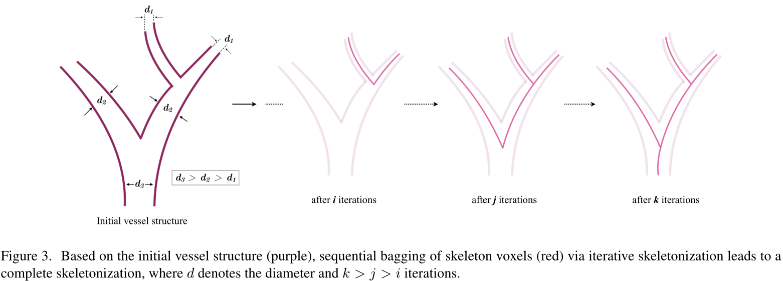 【2021-CVPR】clDice - a Novel Topology-Preserving Loss Function for Tubular Structure Segmentation ...