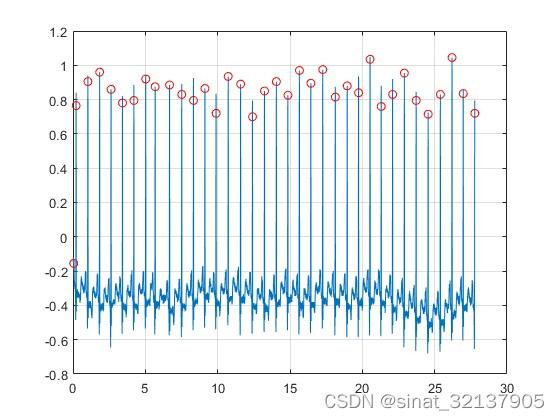 利用MATLAB读取PHYSIONET数据库的具体步骤（一）_wfdb-app-toolbox-0-10-0.zip-CSDN博客