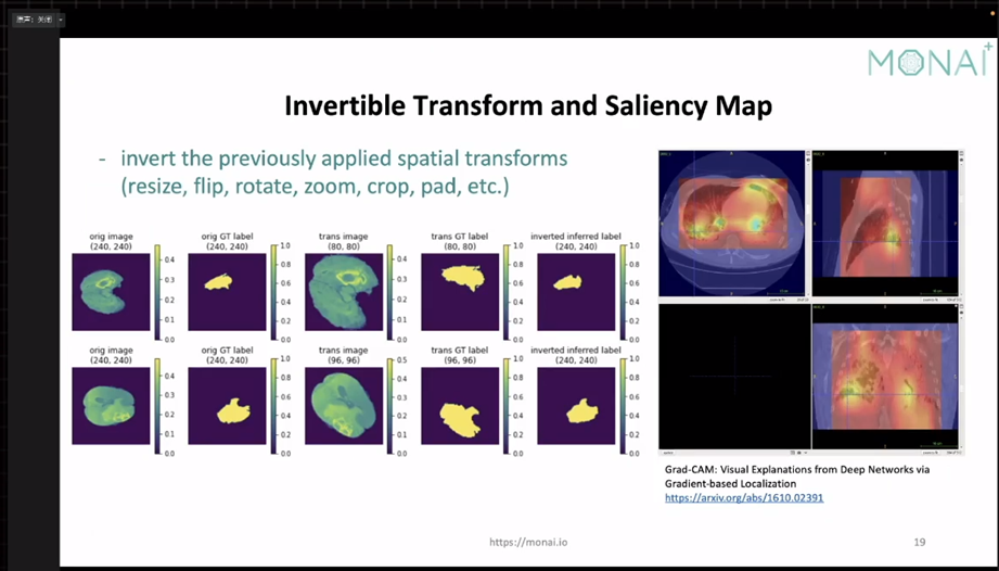 开始monai_smartcachedataset monai-CSDN博客
