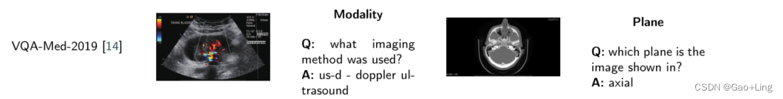 医学视VQA——综述_vqa-rad-CSDN博客