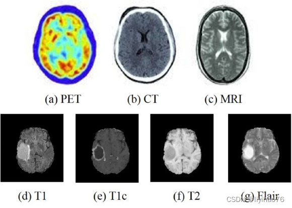 [医学多模态融合系列 -1] A review: Deep learning for medical image segmentation ...