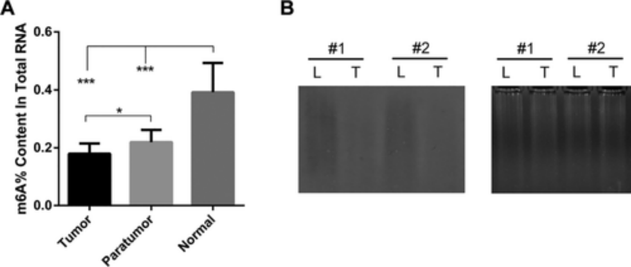 浅谈RNA甲基化研究思路_m6a 和 r-loop-CSDN博客