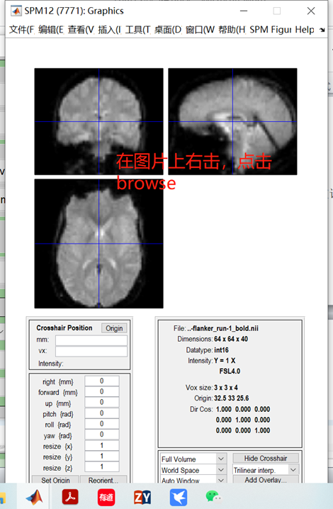 基于spm12对fMRI数据分析_spm12的tpm-CSDN博客