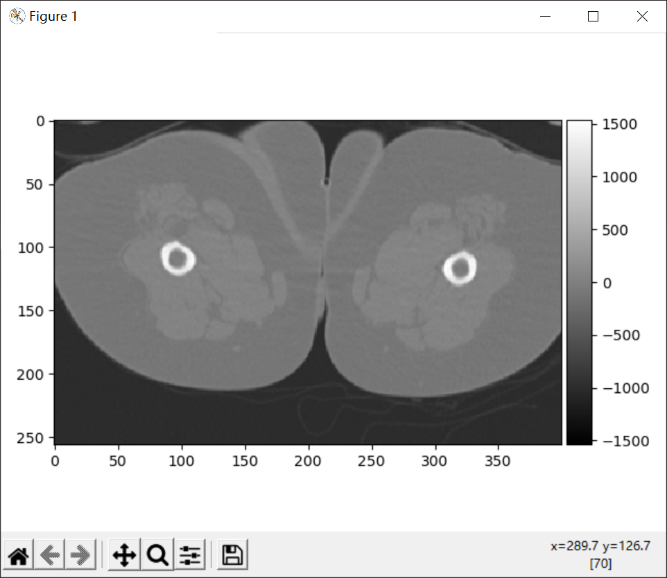 医学图像笔记（三）NIFTI数据格式-CSDN博客