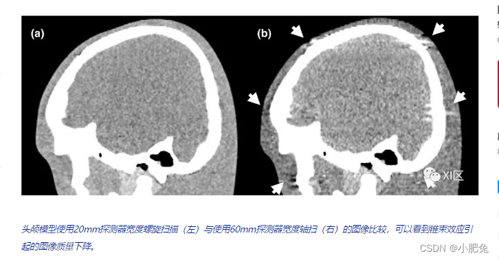 CT伪影：根本原因与规避方法_小鼠ct运动伪影-CSDN博客