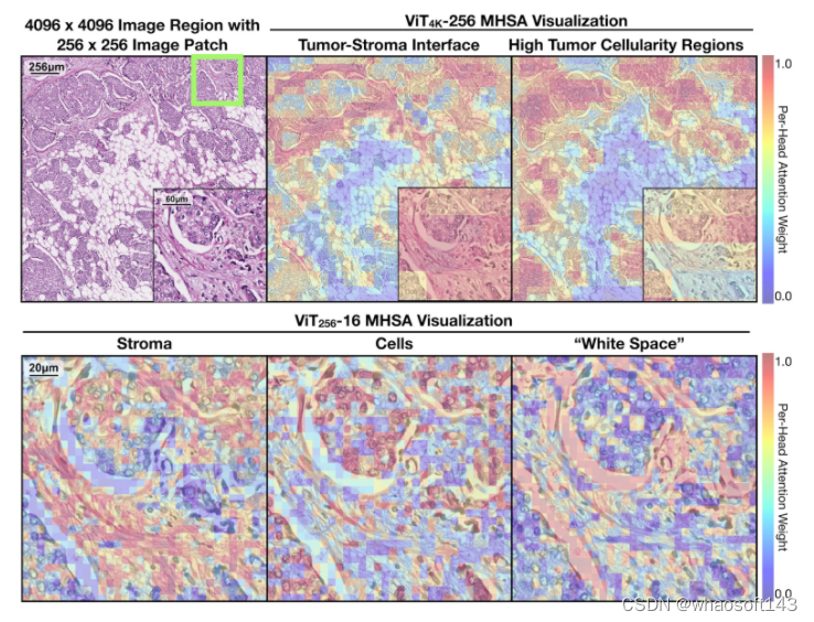 ViT~6_tcga 组织病理全玻片wsi-CSDN博客