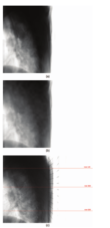 论文阅读：A digitally reconstructed radiograph algorithm calculated from first principles_conebeam数据集 ...