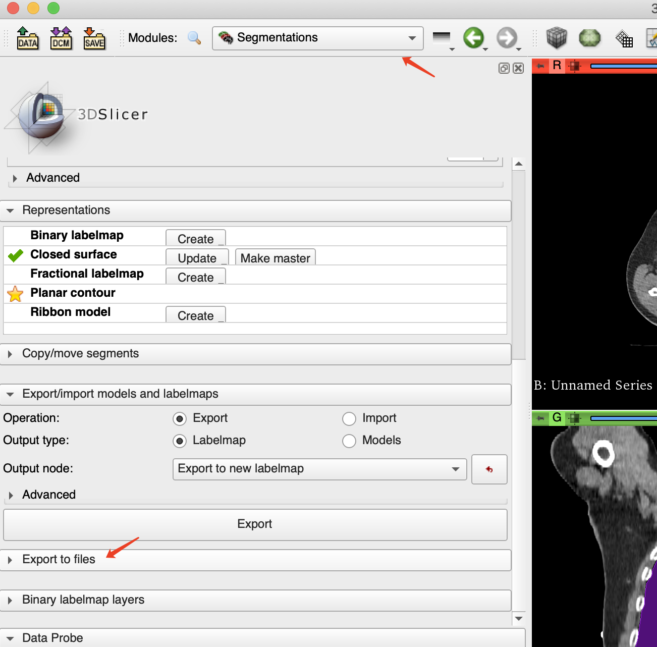 DICOM-RT struct在python中显示mask以及使用3d Slicer转换为nii_吨吨不打野的博客-CSDN博客