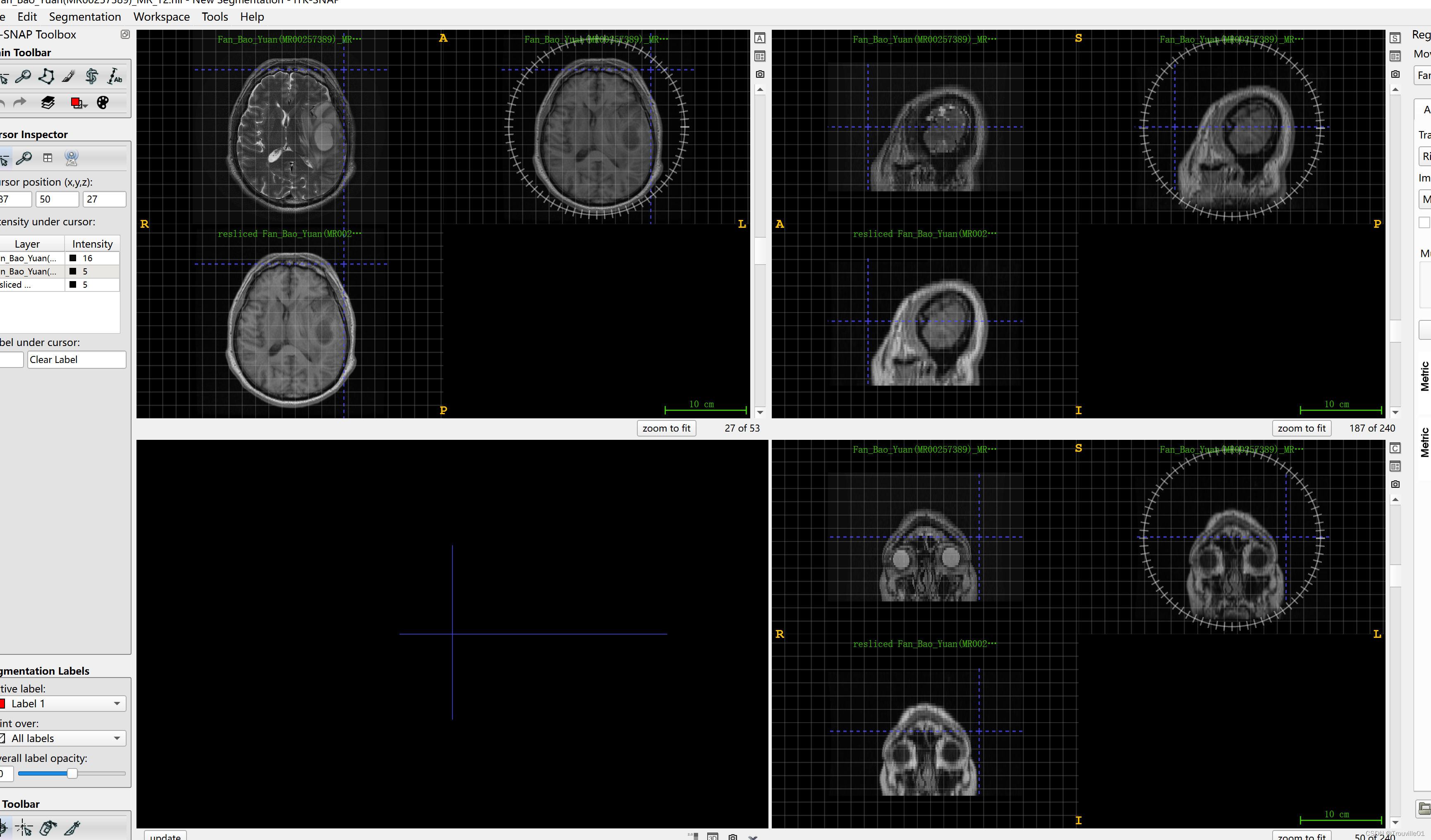 介绍一种医学影像配准的方法（使用itk-snap)_itksnap使用教程-CSDN博客