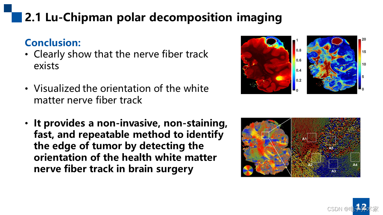 [PPT] Application of Polarization Imaging Techniques in Brain Tumor ...
