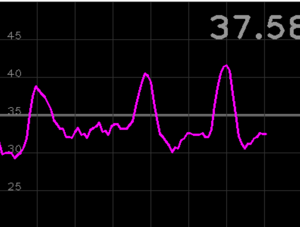 【Opencv+cvzone】实现眨眼计数-CSDN博客