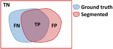 分割评价指标_hd95与assd-CSDN博客