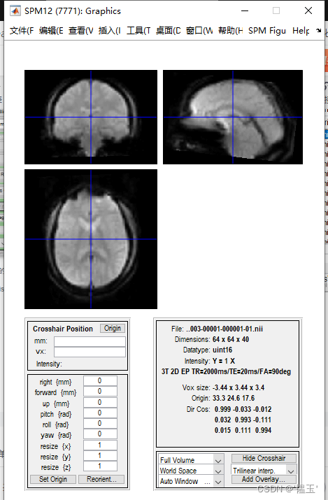 SPM处理fMRI数据的基本步骤_spm 二阶分析-CSDN博客