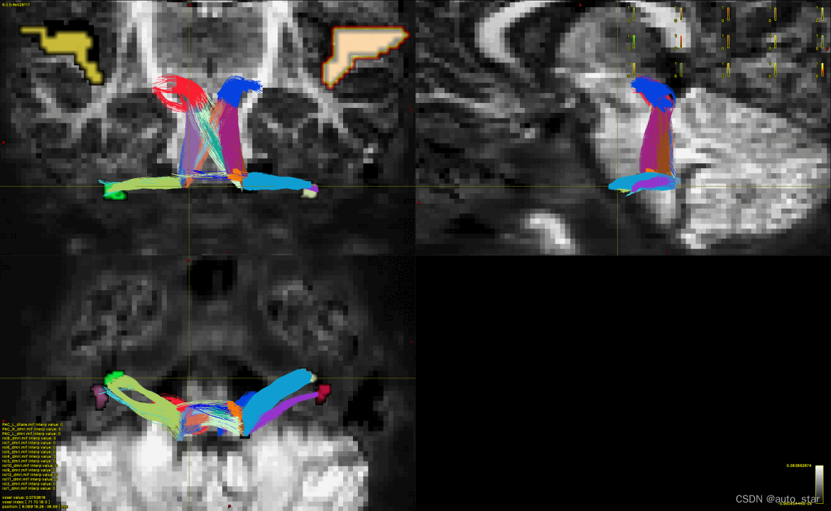 M1 Mac使用Mrivew 显示神经纤维_mrview-CSDN博客