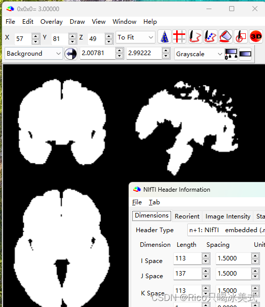 制作指定脑区的maks(包括重采样)_wfu pickatlas-CSDN博客