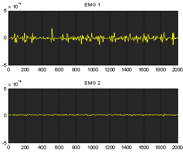sEMG分析-CSDN博客