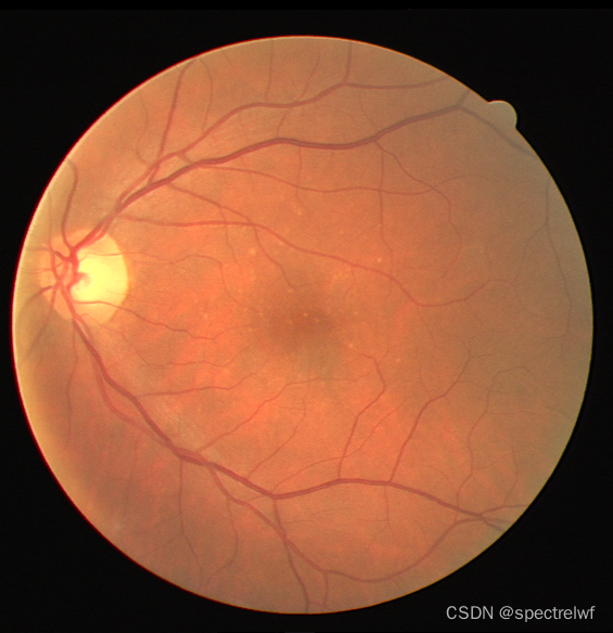 Pytorch实现u Net视网膜血管分割unet Retina Torch Csdn博客