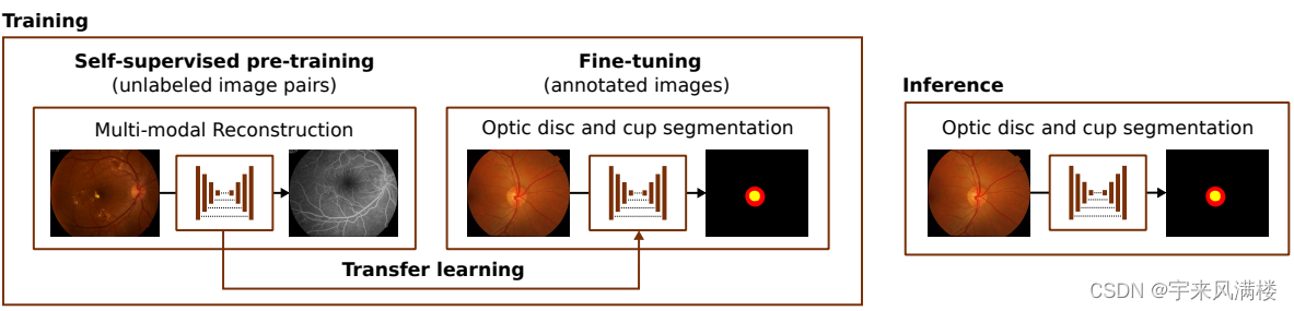 MULTI-MODAL SELF-SUPERVISED PRE-TRAINING FOR JOINT OPTIC DISC AND CUP SEGMENTATION IN EYE FUNDUS ...