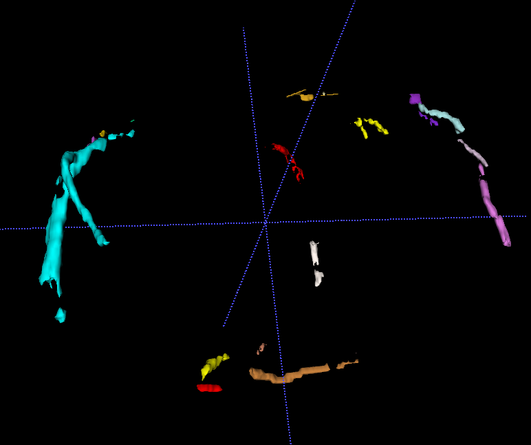 使用SimpleITK进行3D图像连通域分析_连通域分析后处理图-CSDN博客