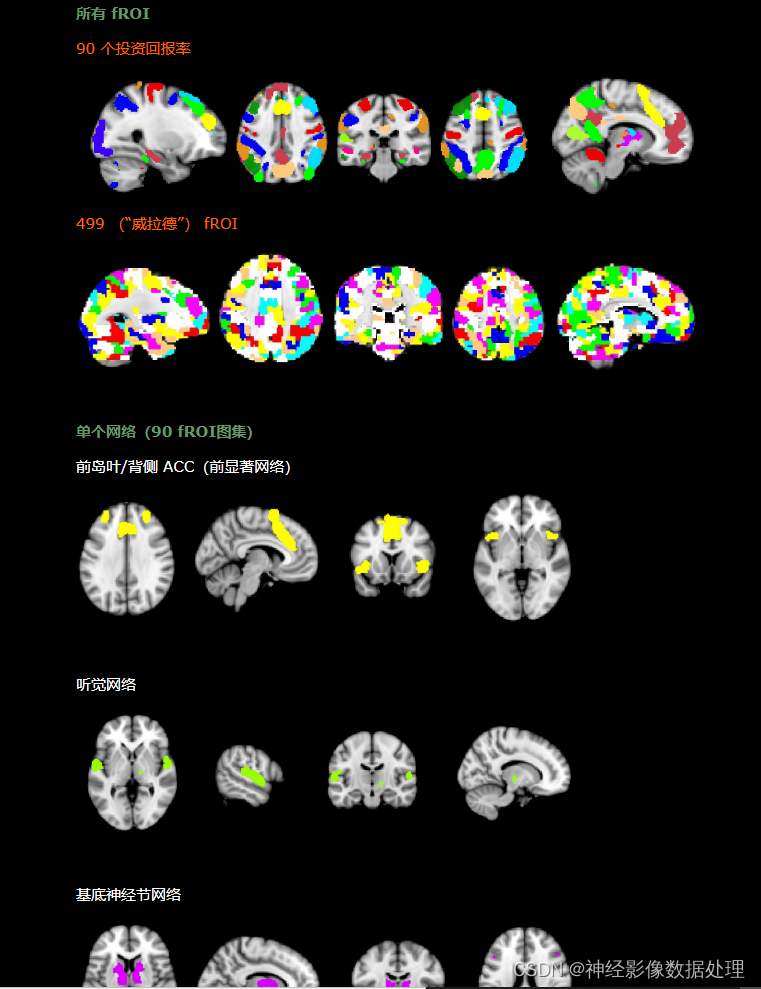 脑功能网络图谱_哪里可以狭窄功能脑网络mask-CSDN博客