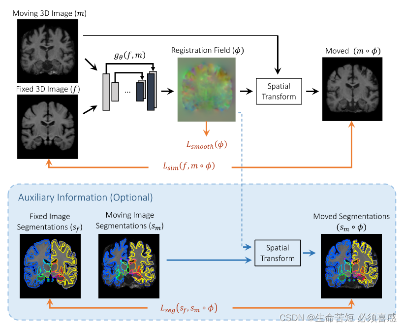 VoxelMorph: A Learning Framework for Deformable Medical Image Registration论文阅读(图像配准的)-CSDN博客