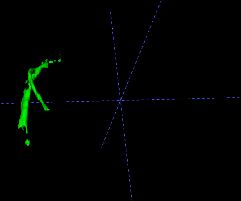 使用SimpleITK进行3D图像连通域分析_连通域分析后处理图-CSDN博客