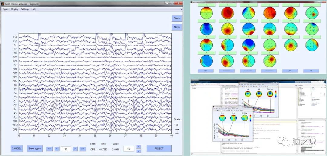 Smarting: The first truly portable and mobile EEG device - Programmer ...