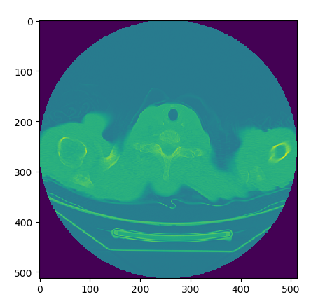 【python】读取dicom文件报错pydicom.errors.InvalidDicomError_pydicom.errors.invaliddicomerror: file is ...
