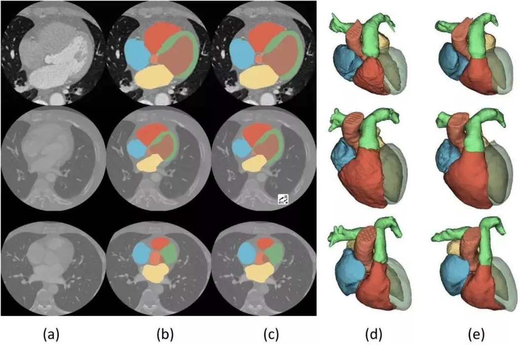 初识：心血管磁共振(CMR)成像-CSDN博客