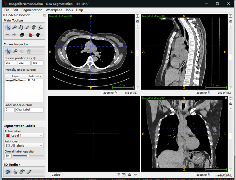 ITK-snap医学图像标注方法（超级详细）——保姆级_itk snap-CSDN博客