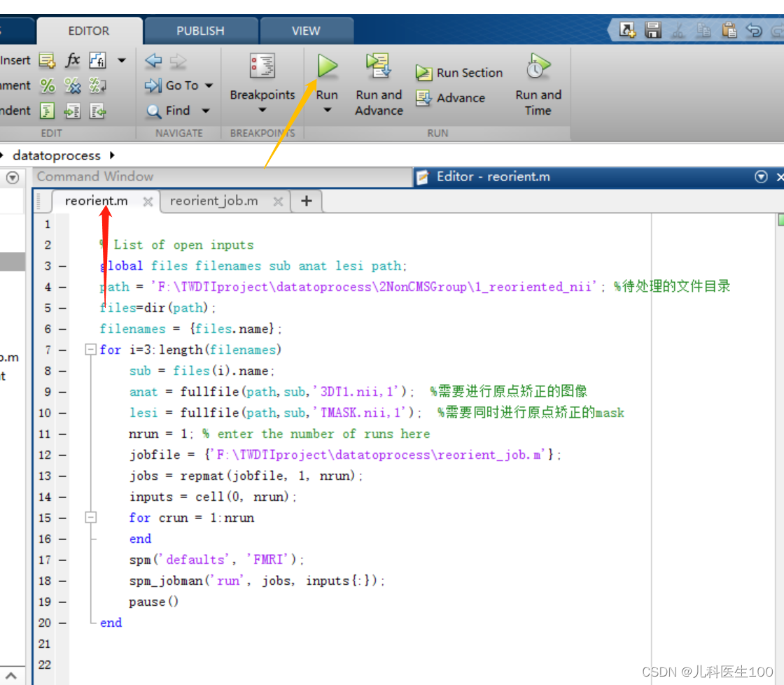 半自动原点矫正_fmri原点矫正-CSDN博客
