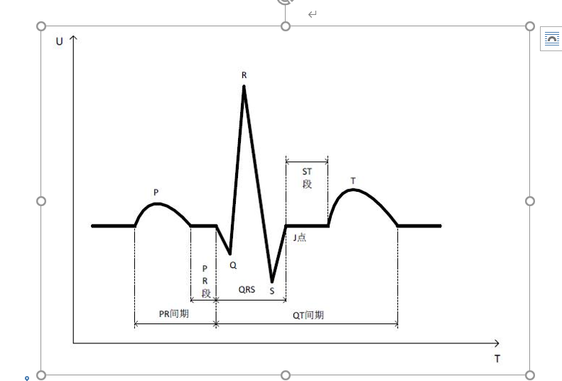 心电监护方案_bmd101-CSDN博客