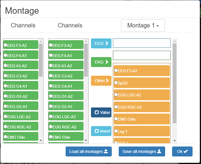 PSG开发.edf文件格式解析_怎样将psg数据存储成edf格式-CSDN博客