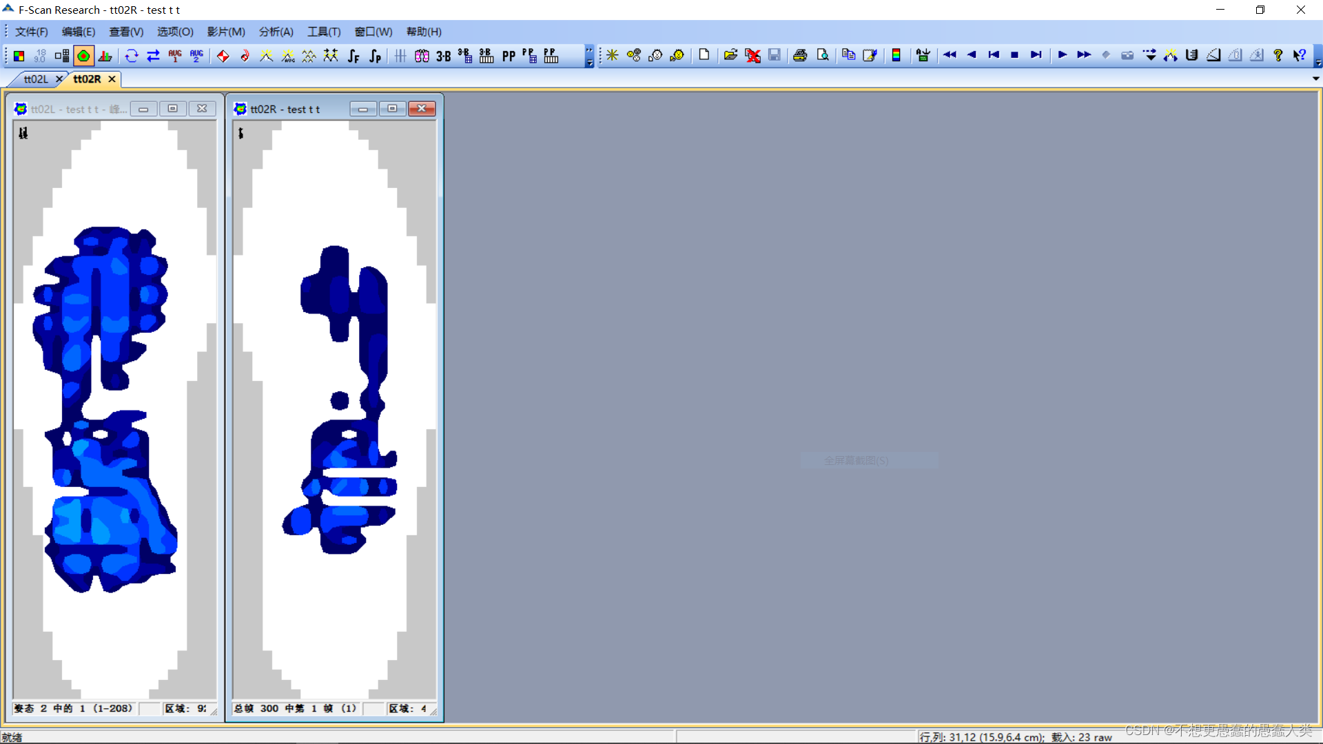 f-scan足底压力分析一：显示选项_足底压力数据集-CSDN博客